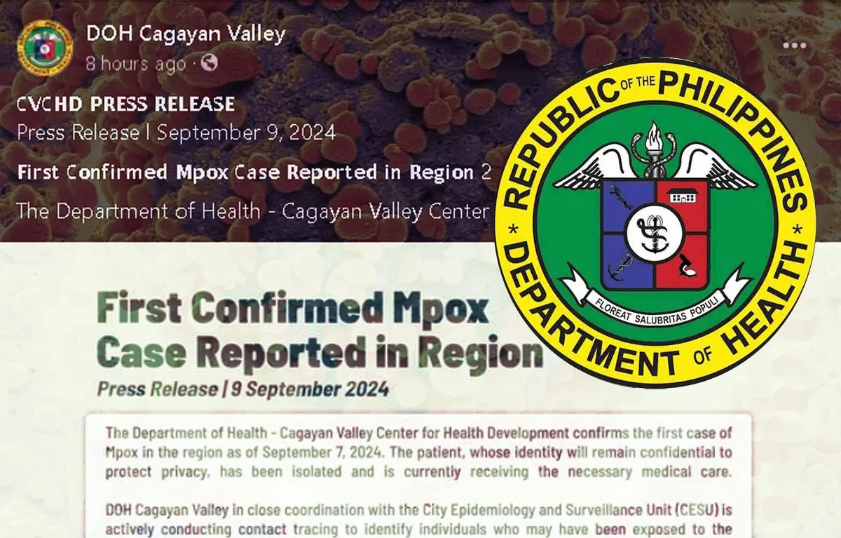 Northern Dispatch | DOH Cagayan Valley urges vigilance after first Mpox ...